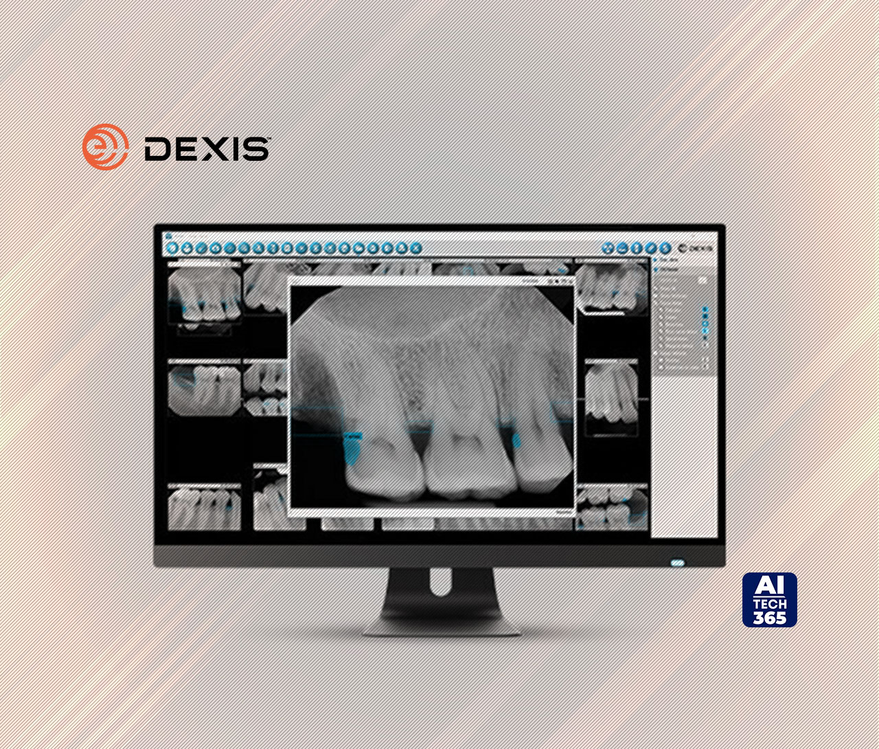 DEXIS Introduces DEXIS 10 Imaging Suite Software featuring the ...