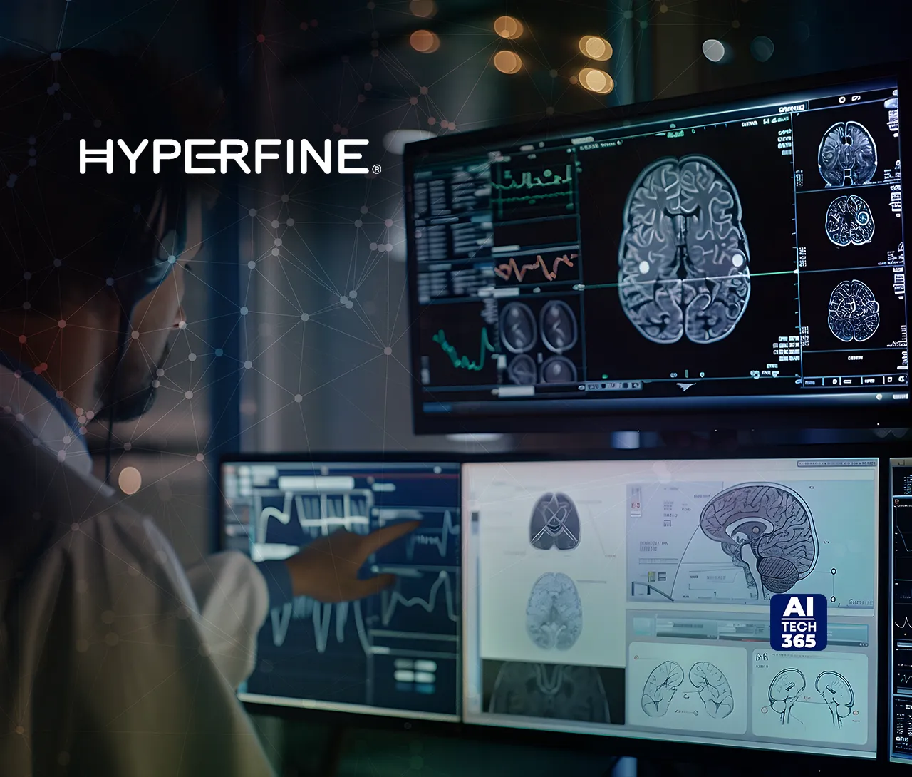 Hyperfine's FDA-Cleared Update Enables Faster Brain Imaging